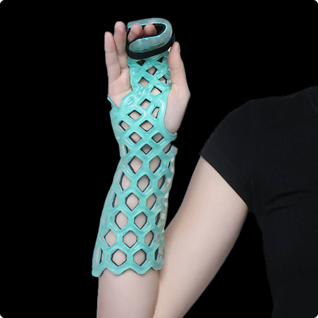 Radial Gutter Immobilizer